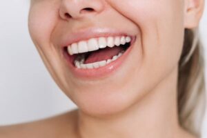Understanding the Different Types of Plaque and How to Remove Them ...